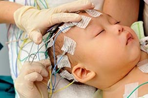 With ASVAB CEP, I explored: Neurodiagnostic Technologists